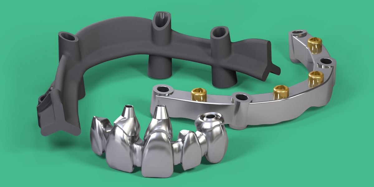 Straumann® CARES® Screw-retained Bars & Bridges